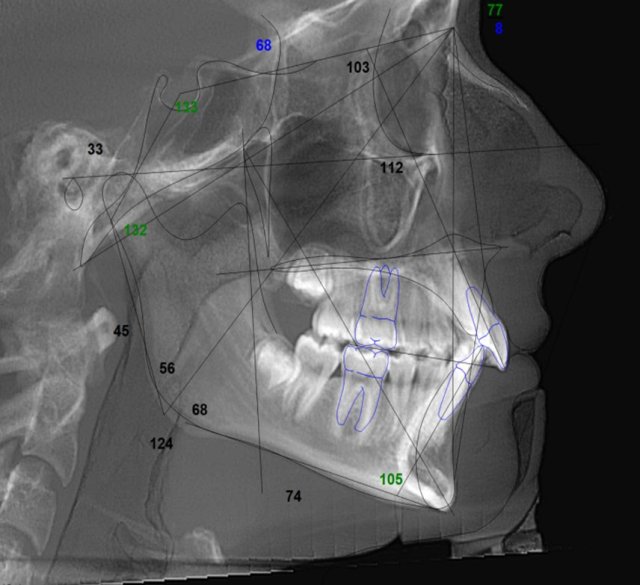 Patients – ddi Imaging Centers